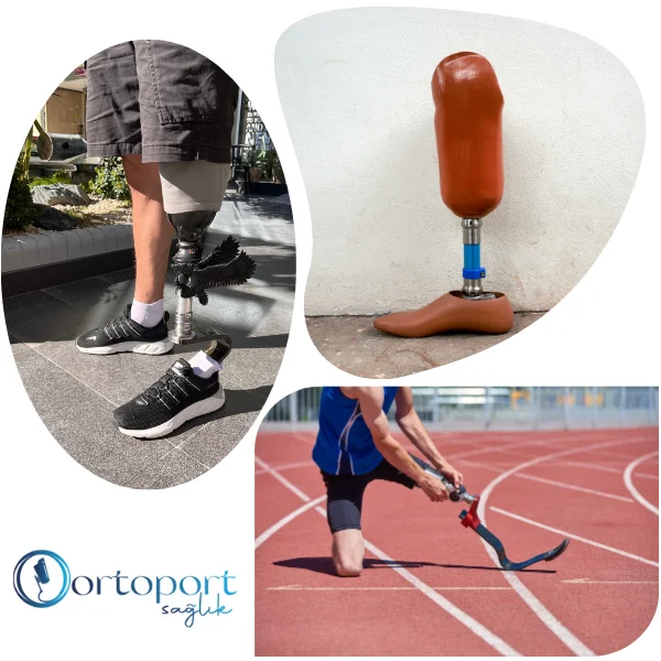 Prosthetic Foot - Ortoport